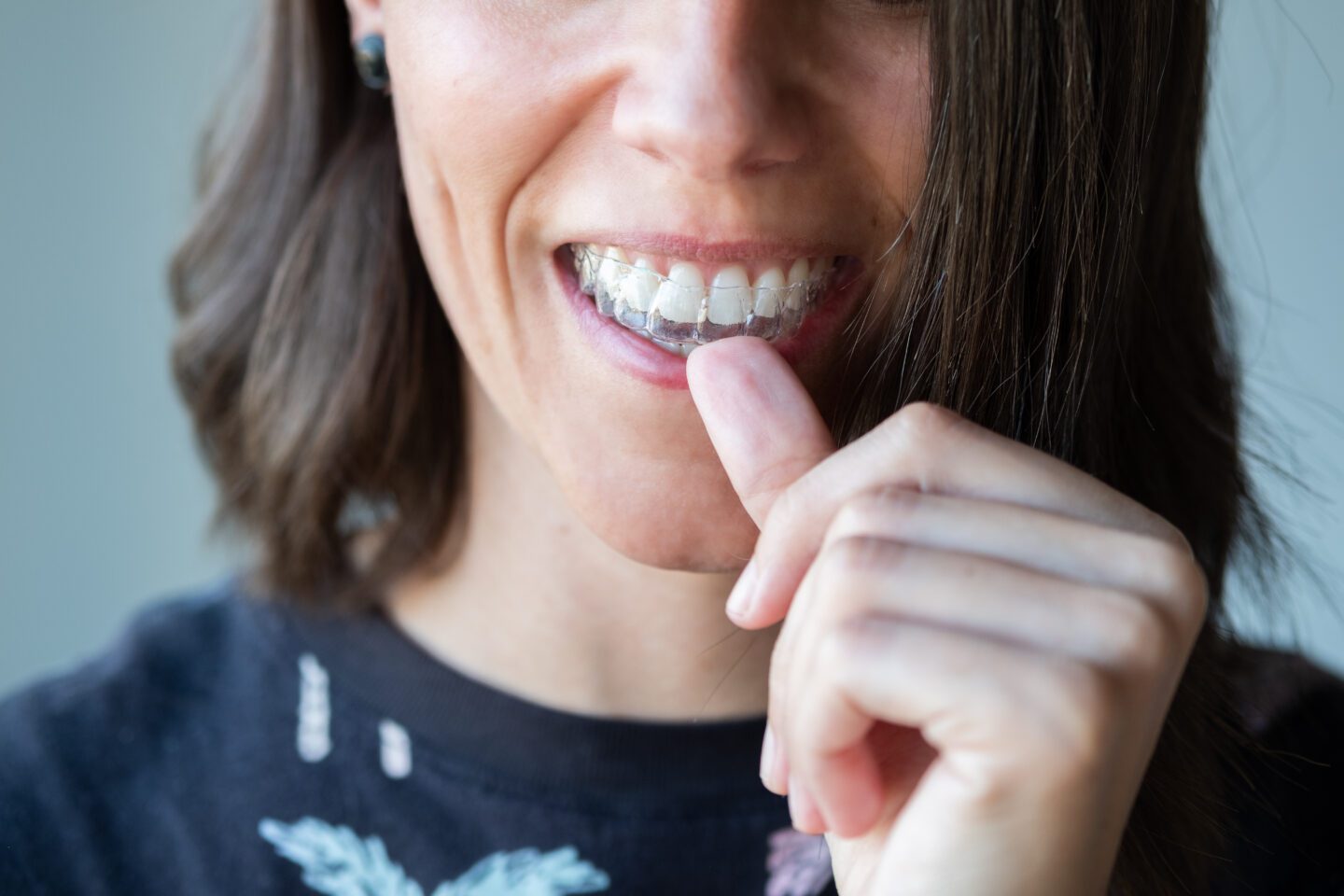 Leading NJ Orthodontist: Transform Your Smile with Invisalign